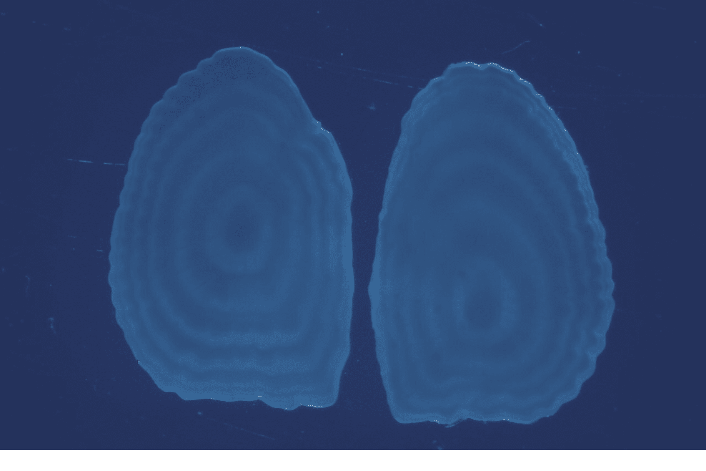 Fish Otoliths - iMagine project
